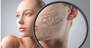 How to get rid of dry skin & redness on face & body fast