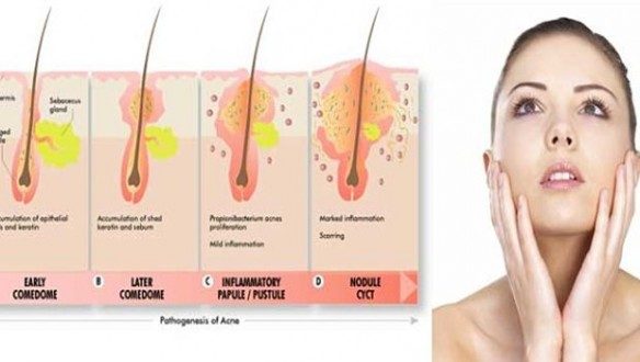 Common skin disorders in toddlers and adults – VKool.com