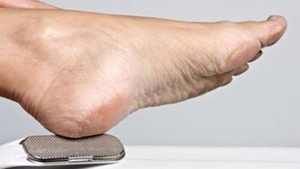 How to remove calluses from feet and fingers naturally – VKool
