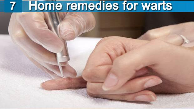 7 home remedies for warts on face and hands